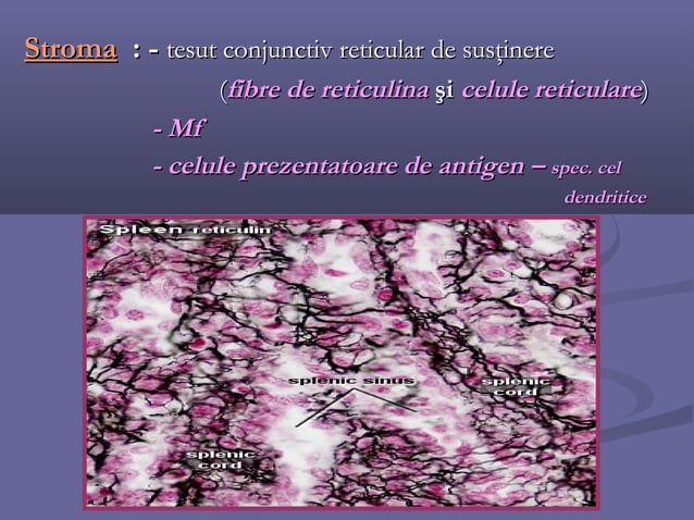 Curs 10-histo-organe-limfoide-periferice | PPT