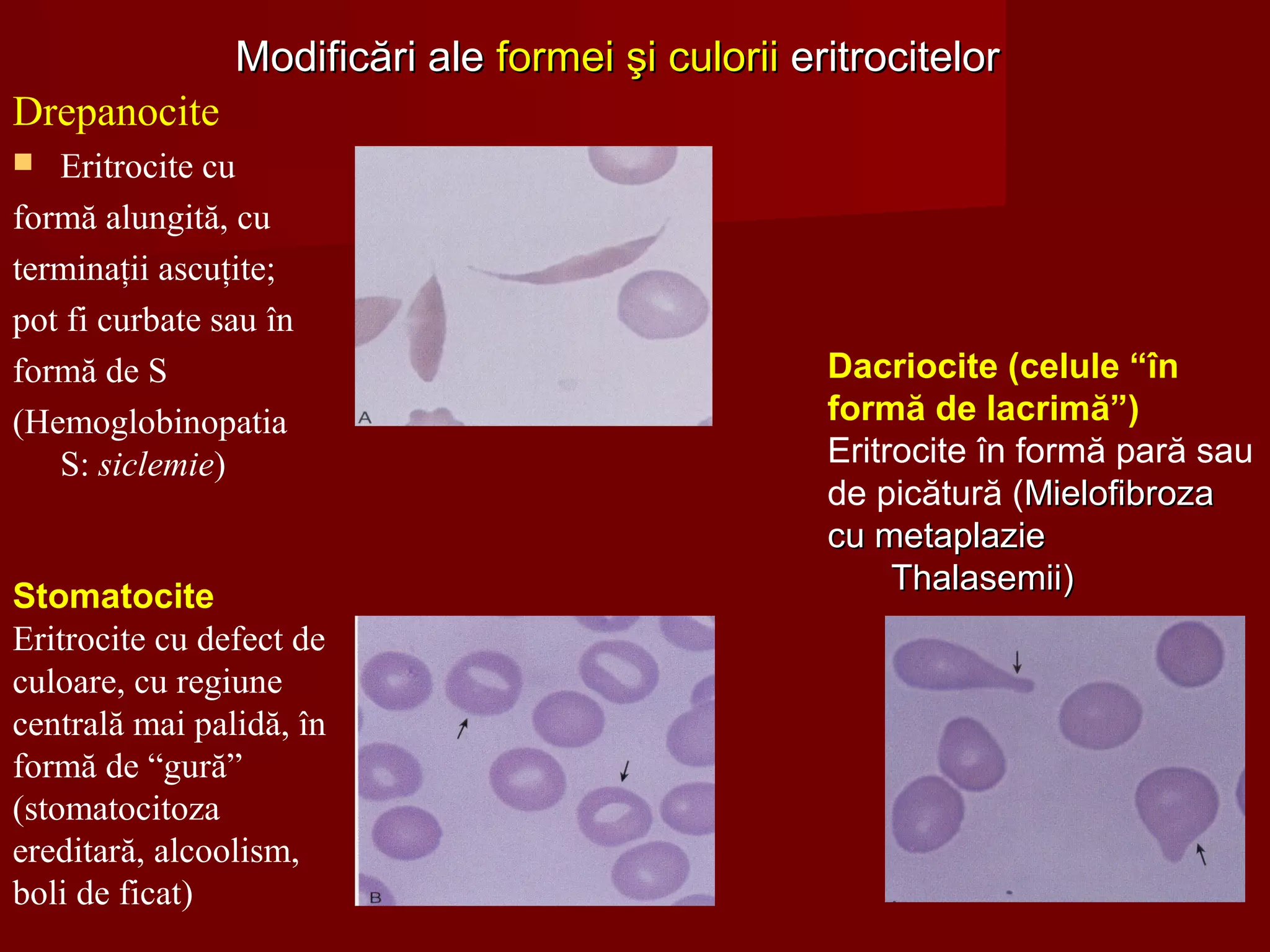 Curs 8-histo-sistemul-tisular-hemo-imun | PPT