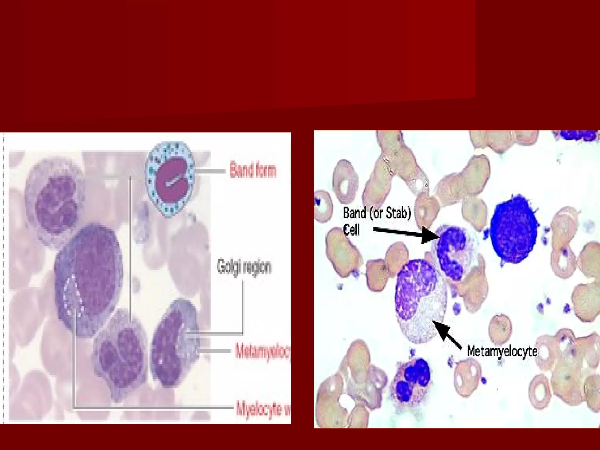 Curs 8-histo-sistemul-tisular-hemo-imun | PPT