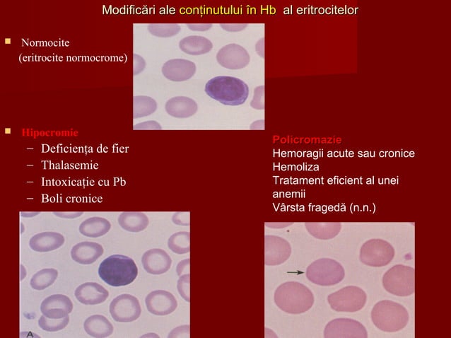 Curs 8-histo-sistemul-tisular-hemo-imun | PPT