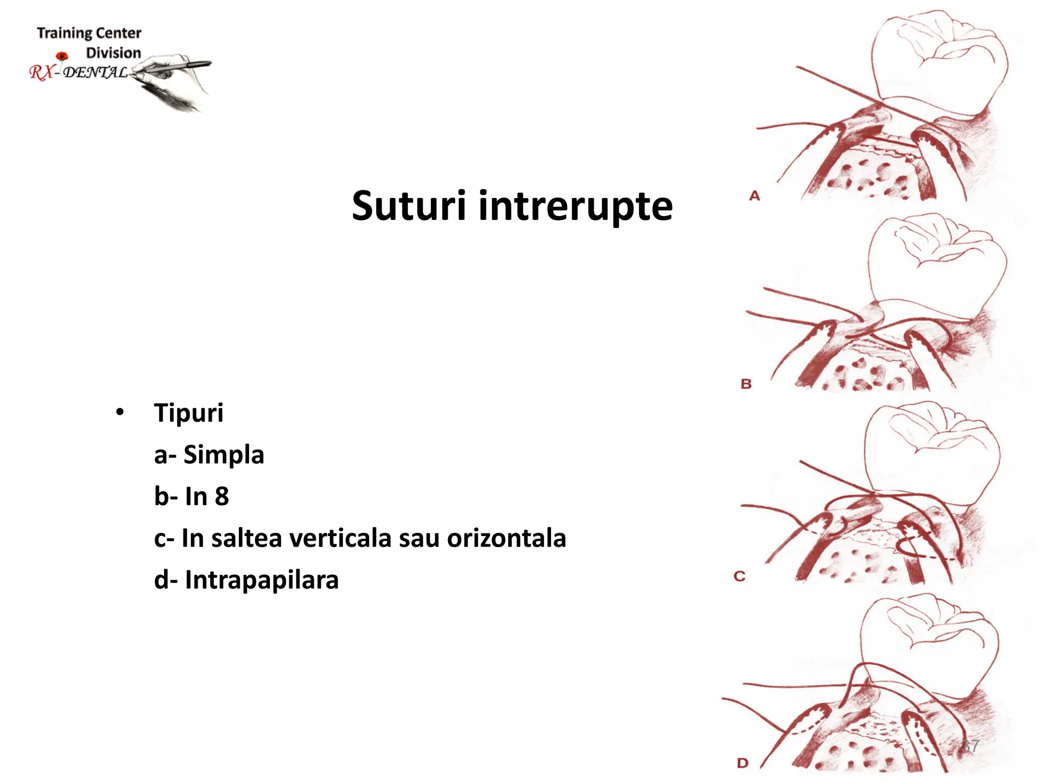 Curs-Suturi...................................pdf