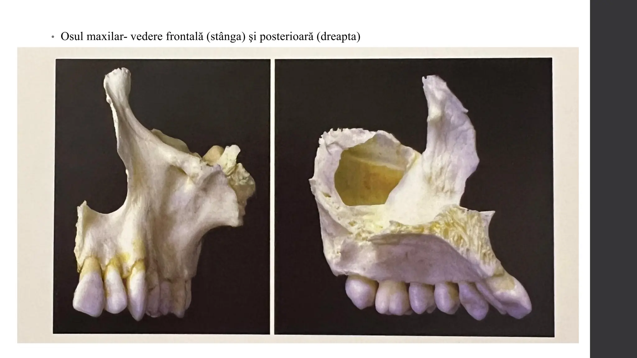 Terapie Implanto-Protetica.pdf