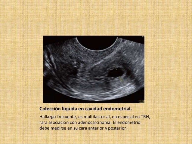 Patologia endometrial
