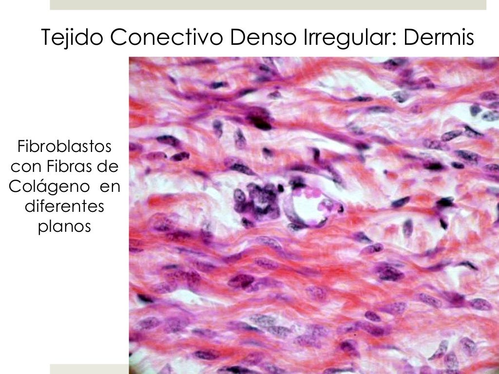 Histologia De Tecido Conjuntivo Denso Irregular