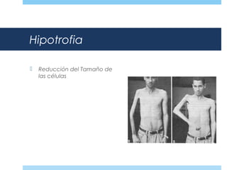 Curso Histologia 21 Conceptos en Histopatologia | PPT