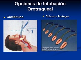 Curso intubacion | PPT