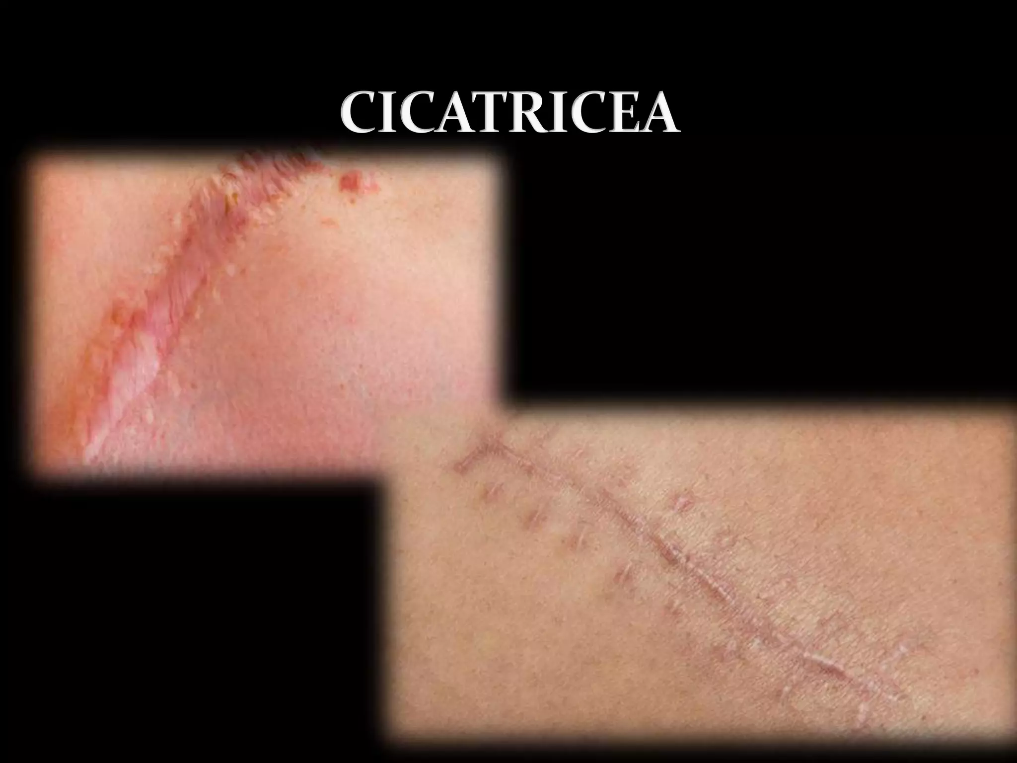 Patologia cutanata.pptx