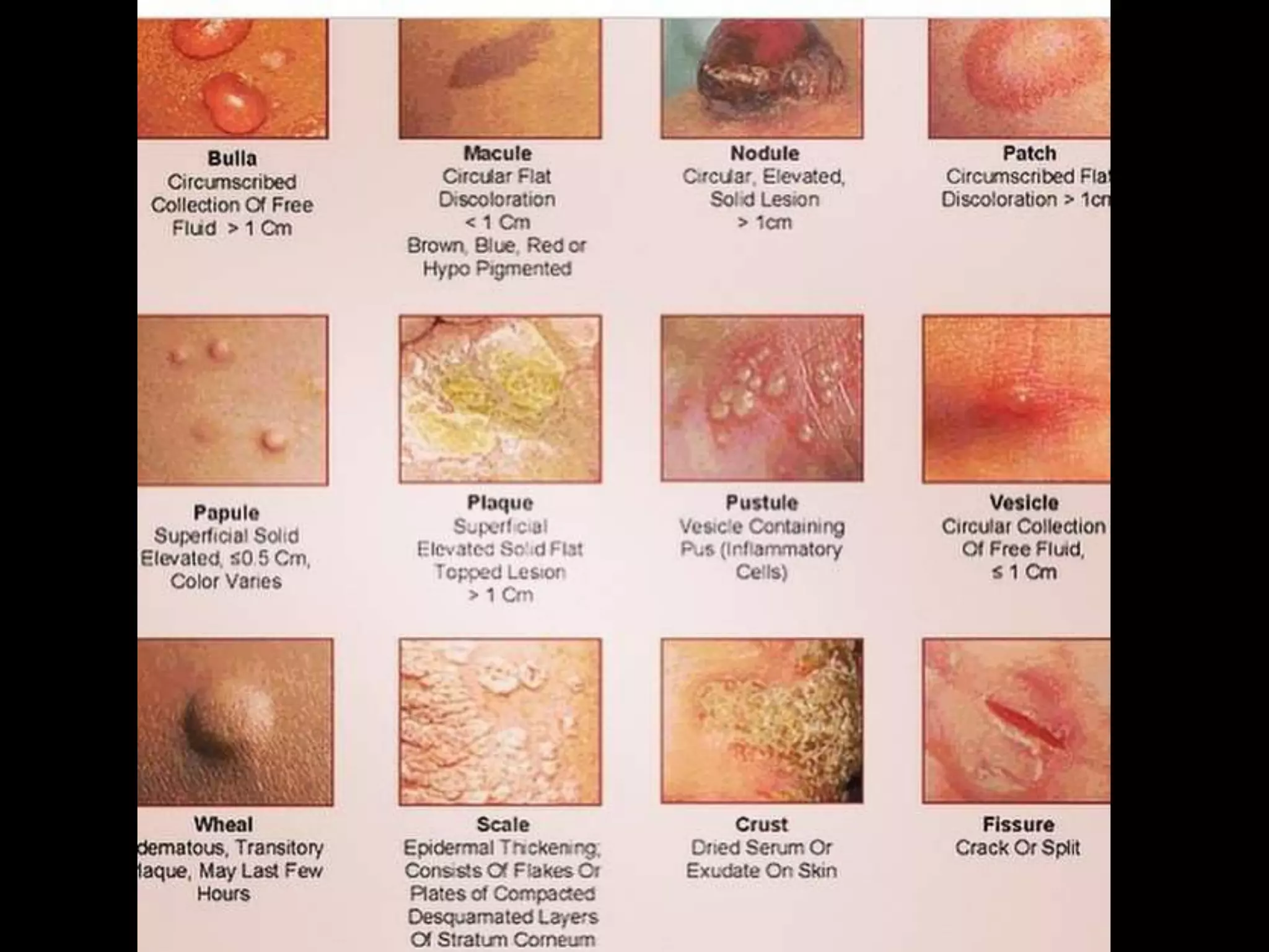 Patologia cutanata.pptx