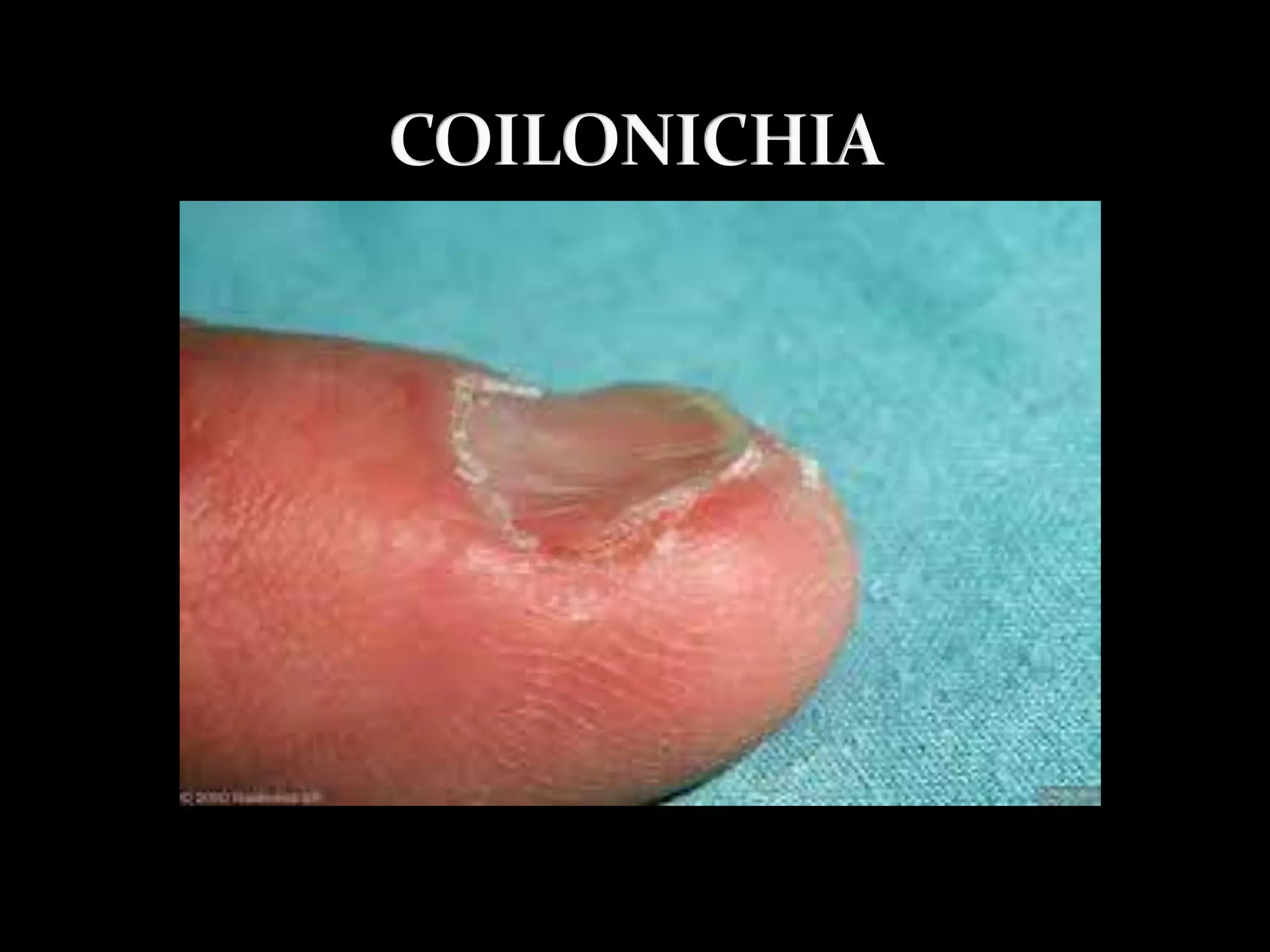 Patologia cutanata.pptx