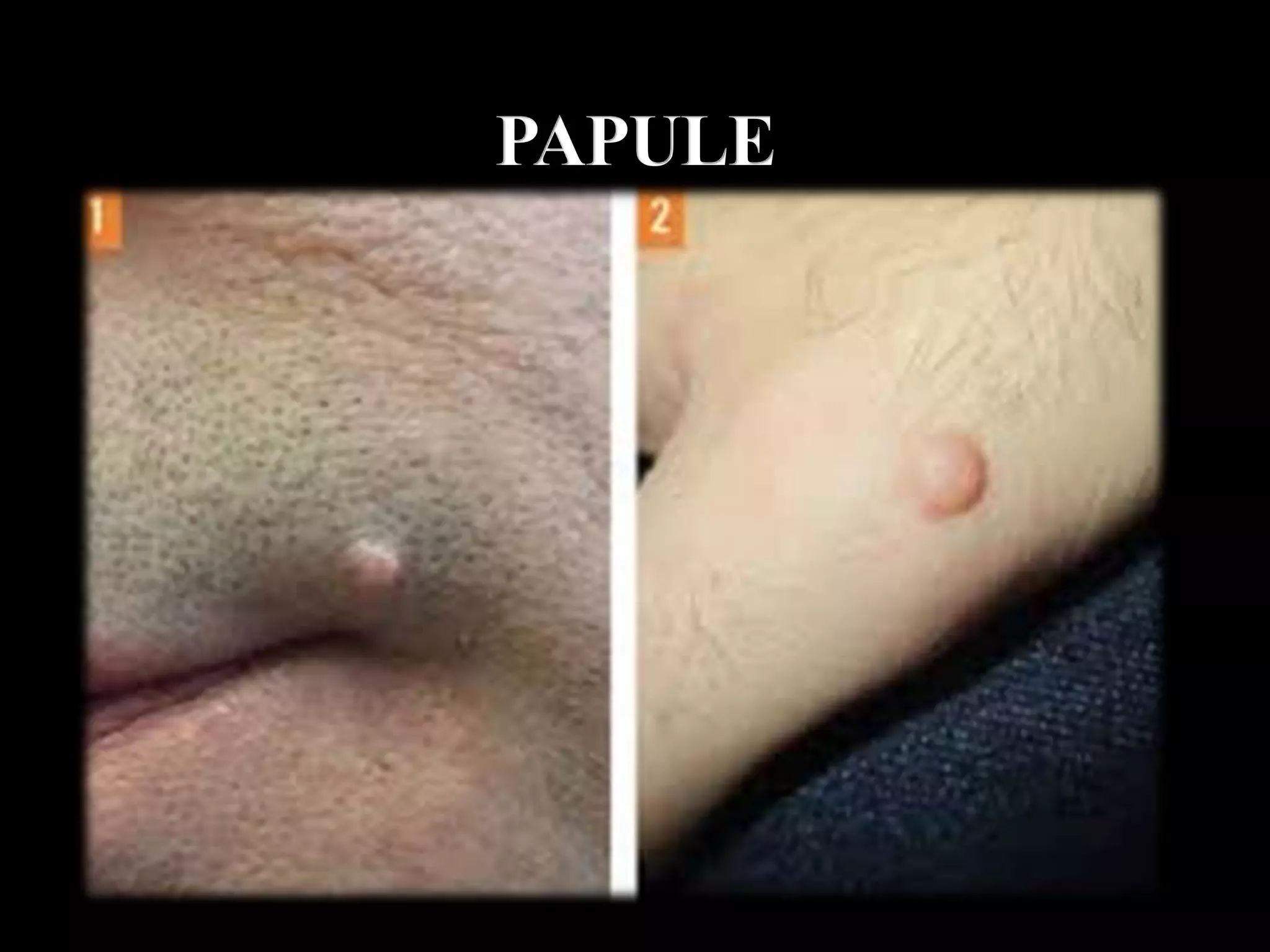 Patologia cutanata.pptx
