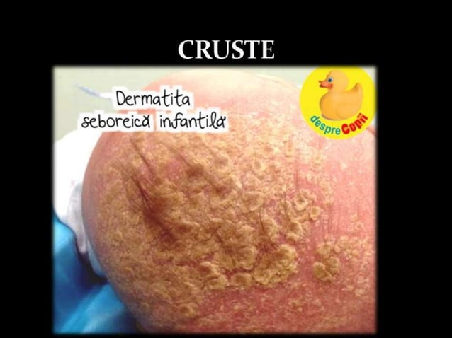 Patologia cutanata.pptx