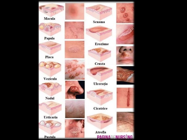 Patologia cutanata.pptx