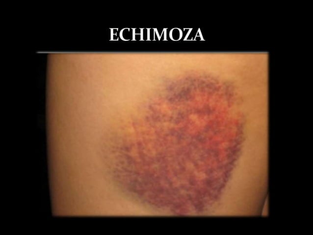 Patologia cutanata.pptx