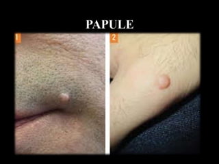 Patologia cutanata.pptx