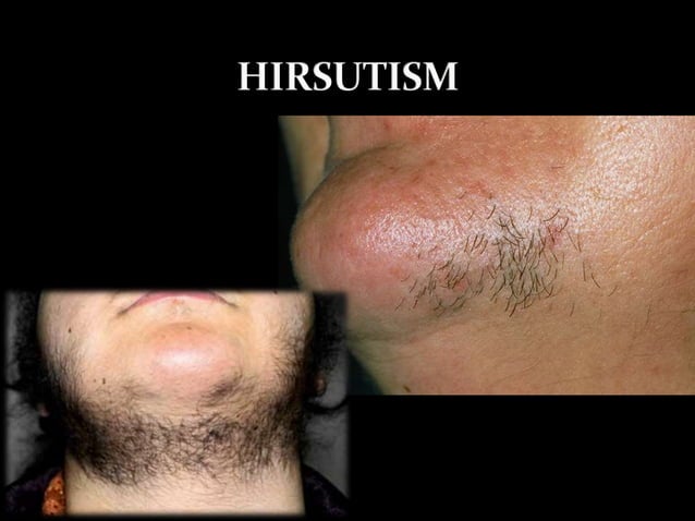 Patologia cutanata.pptx