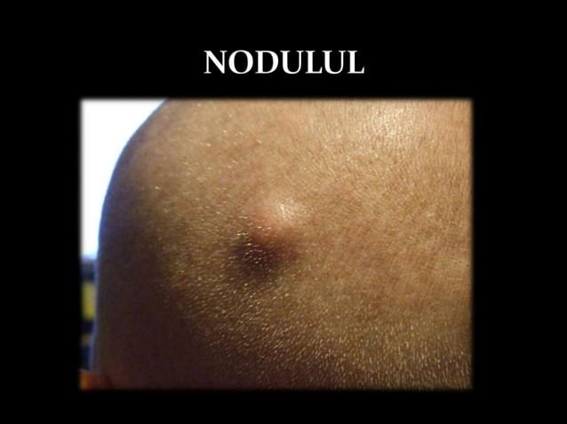 Patologia cutanata.pptx