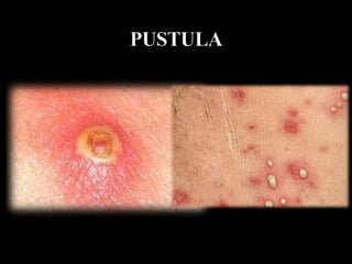 Patologia cutanata.pptx