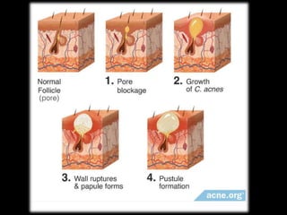 Patologia cutanata.pptx