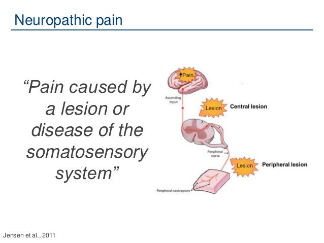Neuropathic pain: an overview