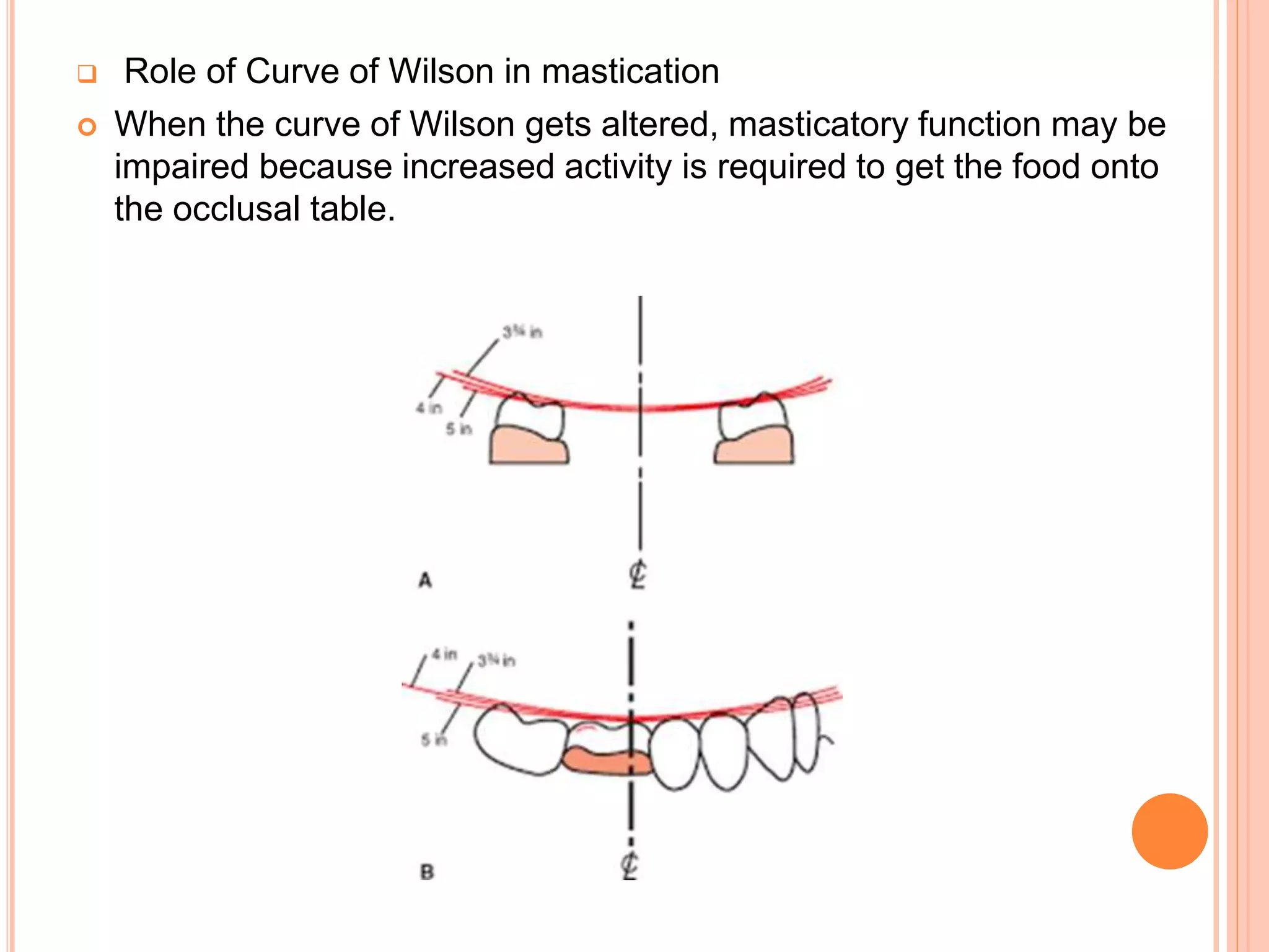 Compensating Curves in Prosthodontics | PPTX
