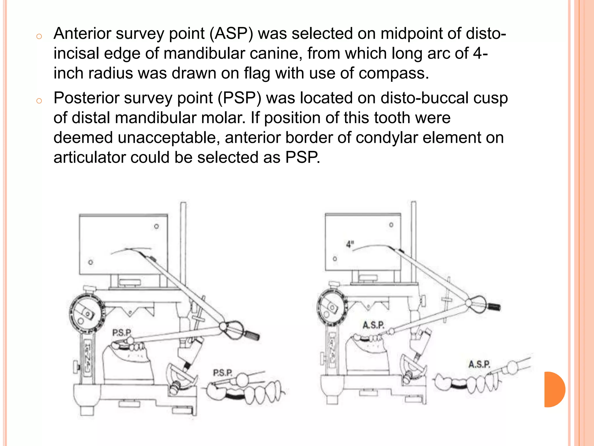 Compensating Curves in Prosthodontics | PPTX