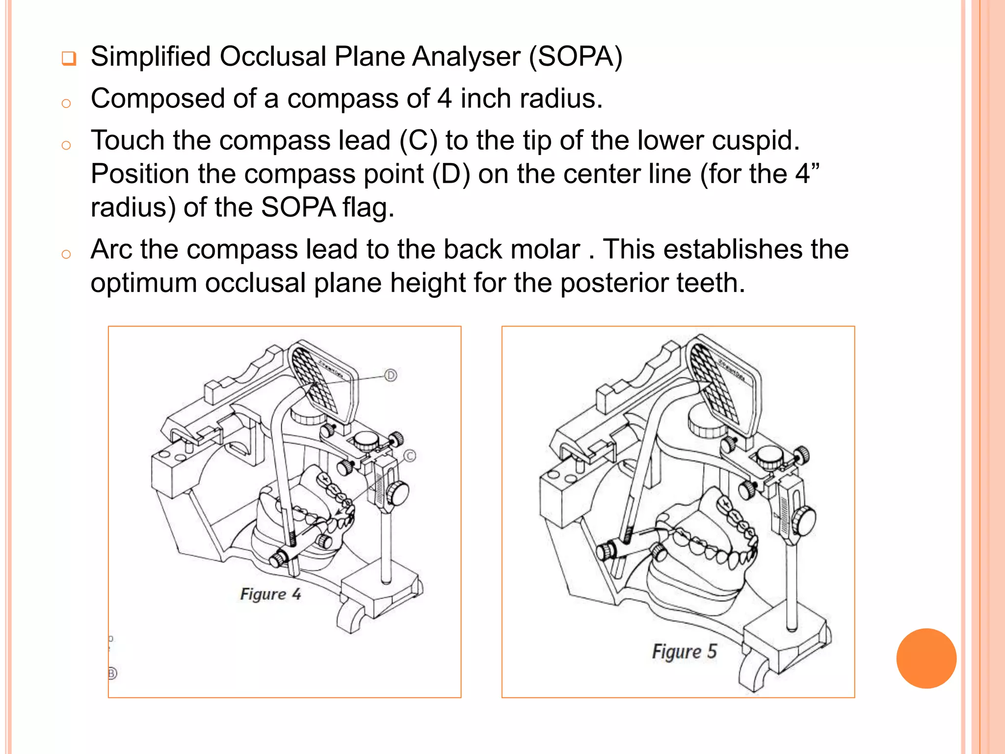 Compensating Curves in Prosthodontics | PPTX