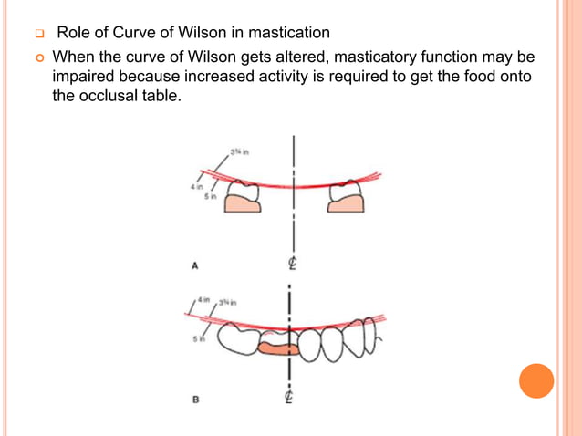 Compensating Curves in Prosthodontics | PPTX