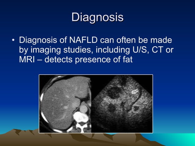 NAFLD, NASH | PPT | Endocrine and Metabolic Diseases | Diseases and ...