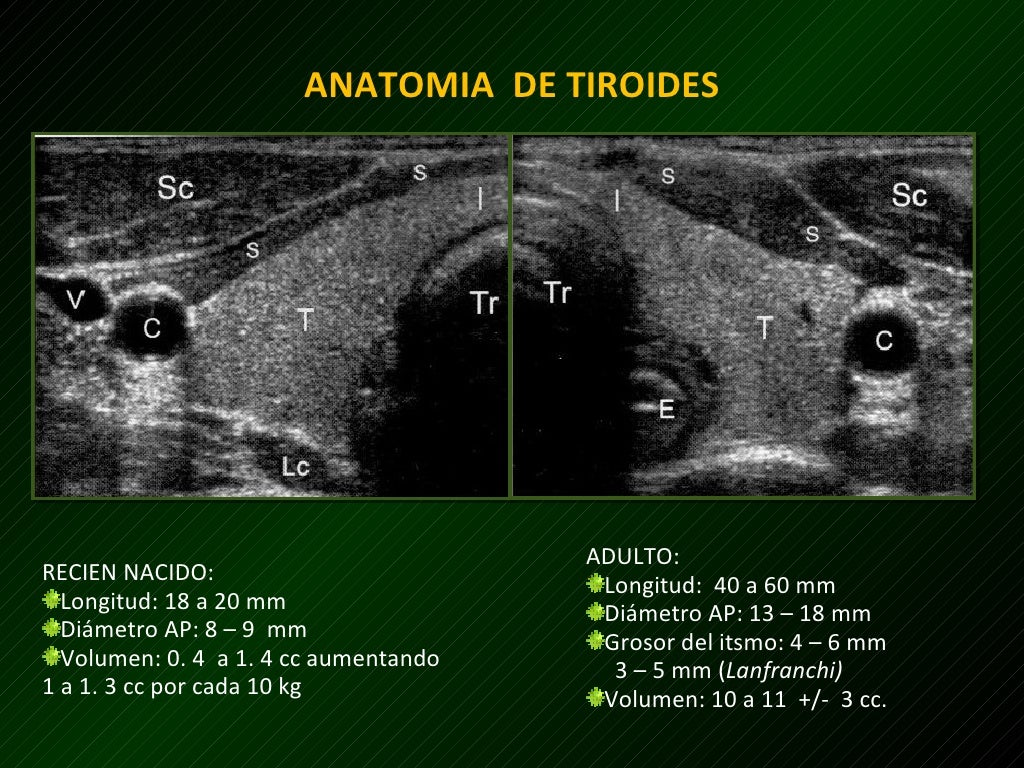 ULTRASONIDO DE TIROIDES