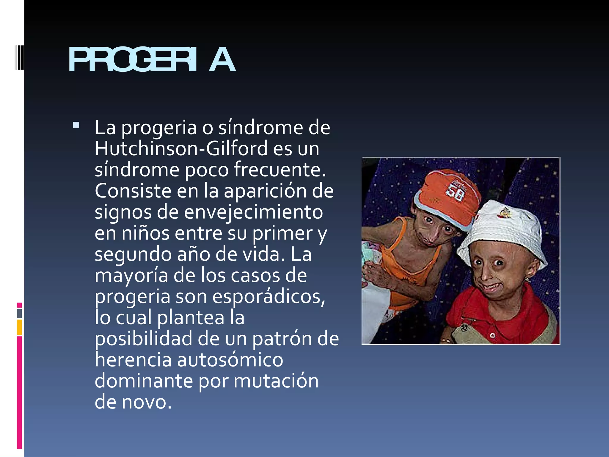 progeria | PPT
