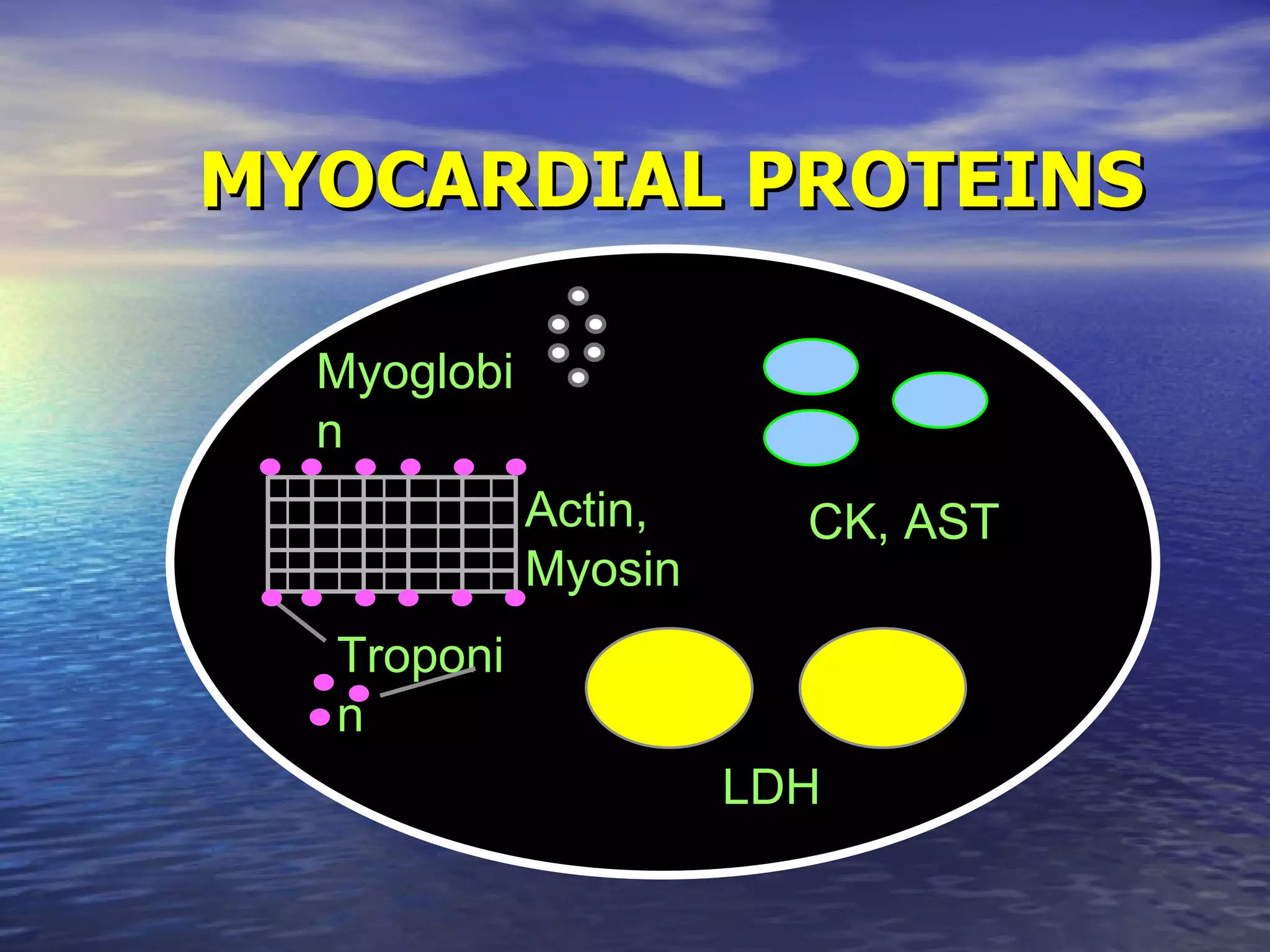 ACUTE MYOCARDIA INFARCTION ISCHEMIA MI Draz MY | PPT | Heart and ...