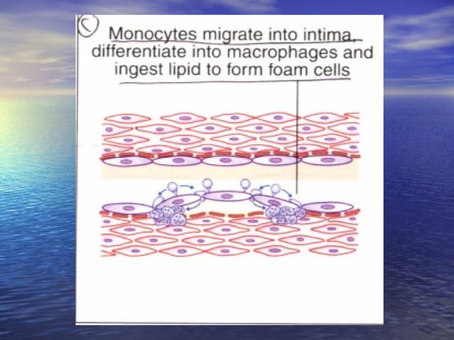 ACUTE MYOCARDIA INFARCTION ISCHEMIA MI Draz MY | PPT | Heart and ...