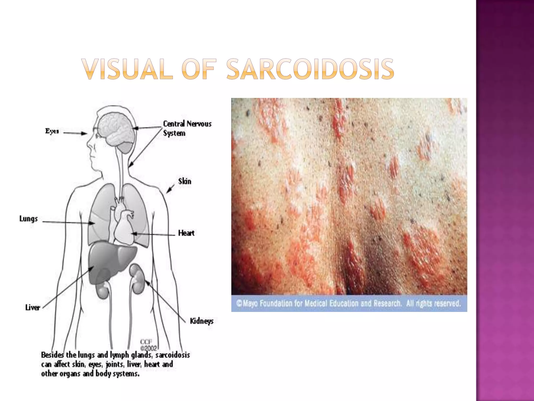 Chapter 6 Presentation | PPTX