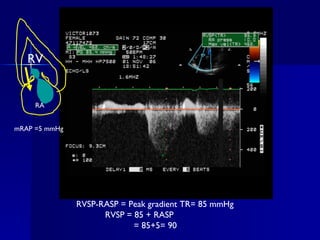 Cardiac Investigation In Heart Failure | PPT