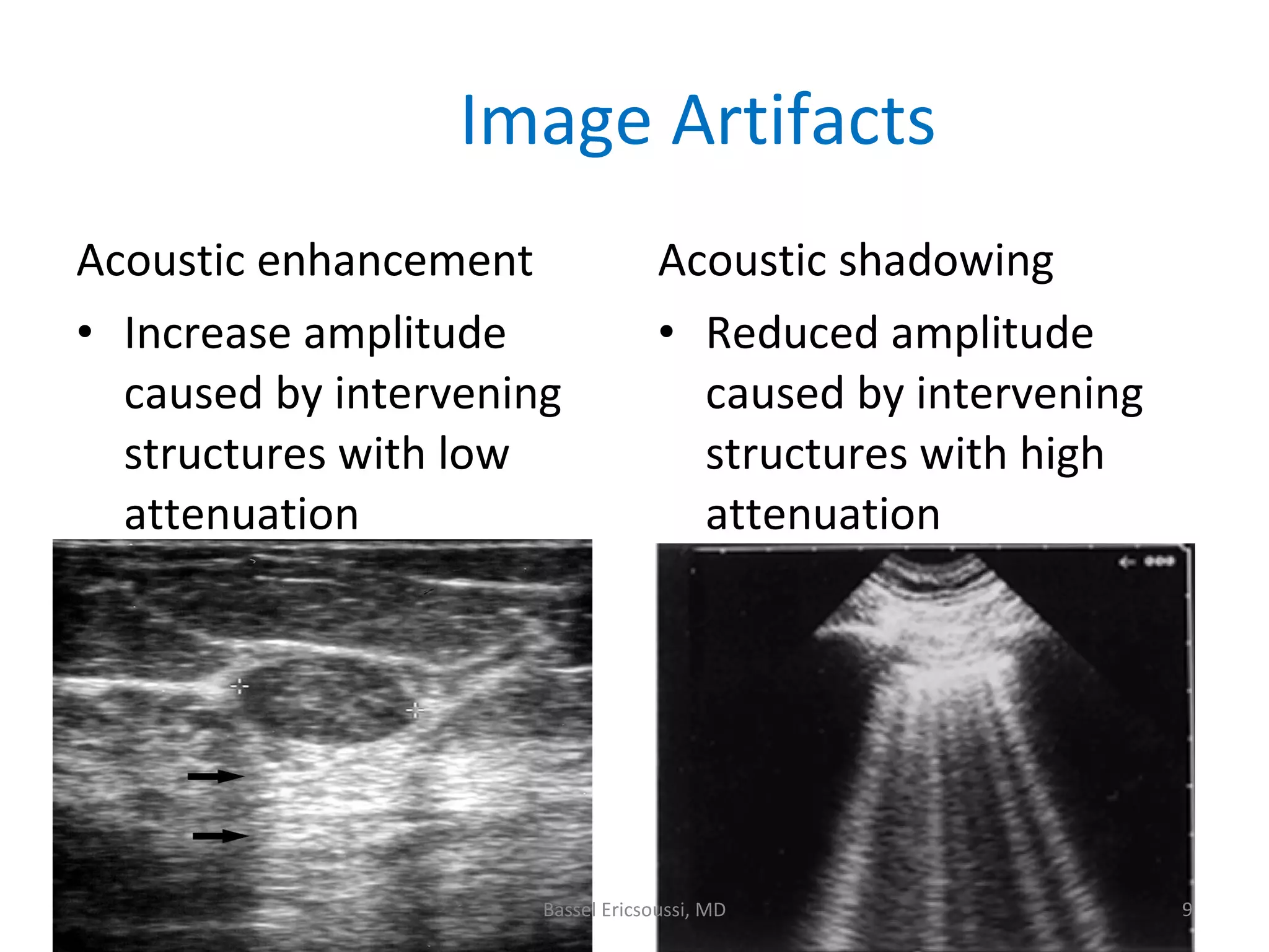 Ultrasonography Fundamentals In Critical Care: Lung Ultrasound, Pleural ...