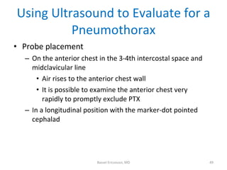 Ultrasonography Fundamentals In Critical Care: Lung Ultrasound, Pleural ...