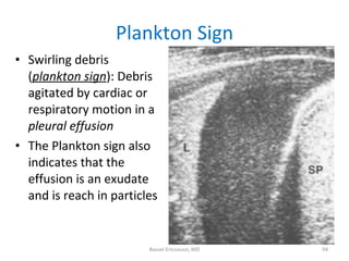 Ultrasonography Fundamentals In Critical Care: Lung Ultrasound, Pleural ...