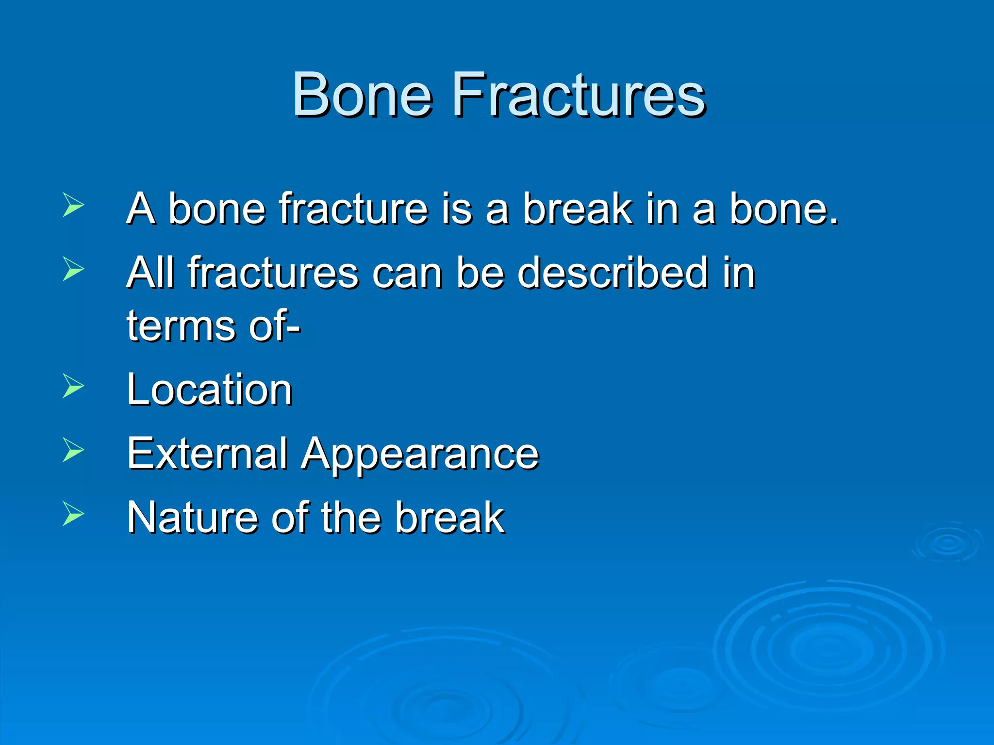 FRACTURES | PPT