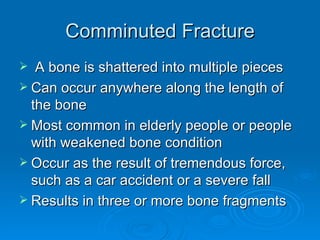 FRACTURES | PPT