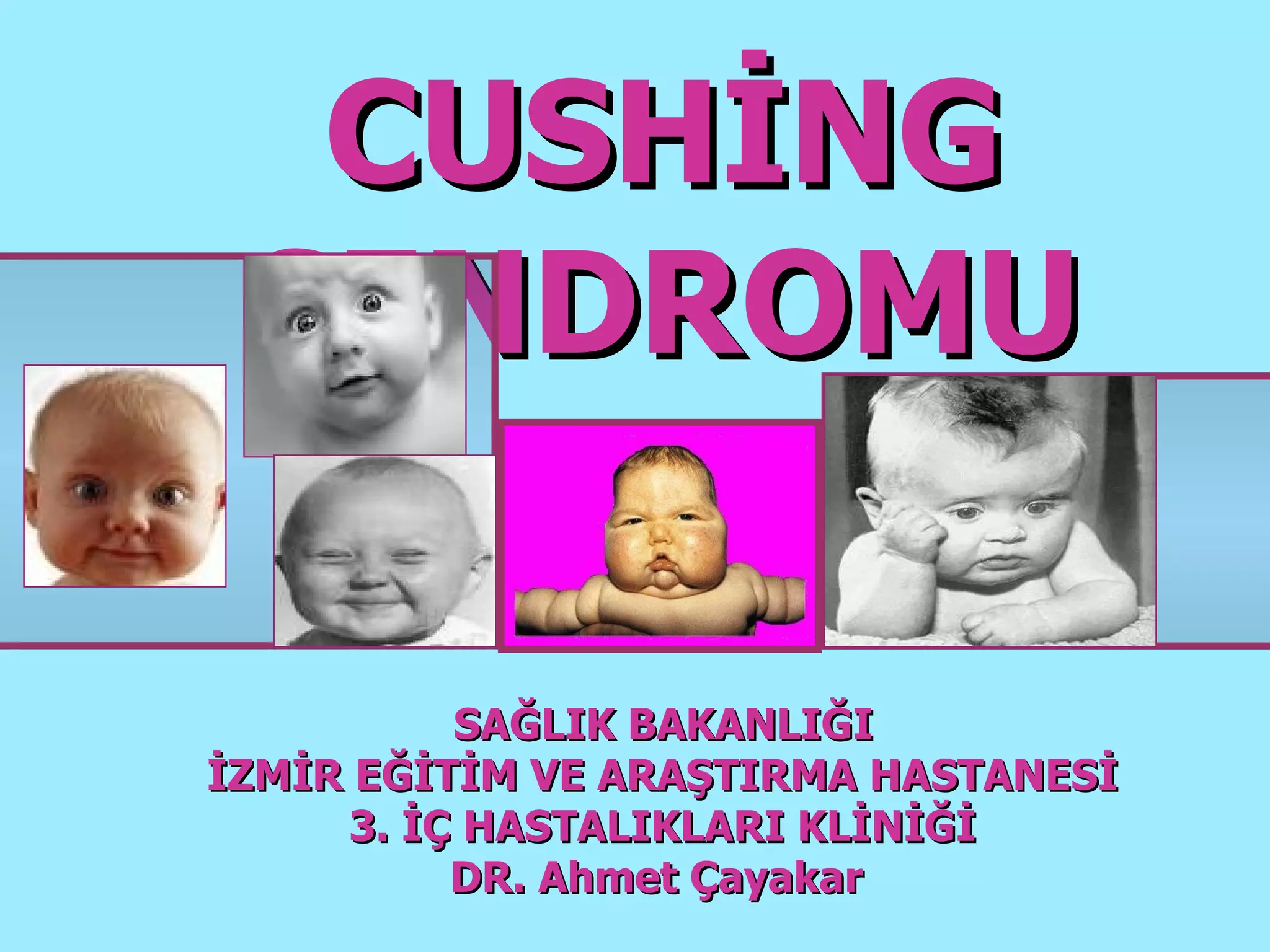Cushing Sendromu | PPT