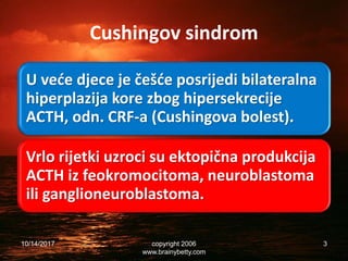 Cushingov sindrom | PPSX