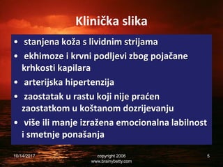 Cushingov sindrom | PPSX