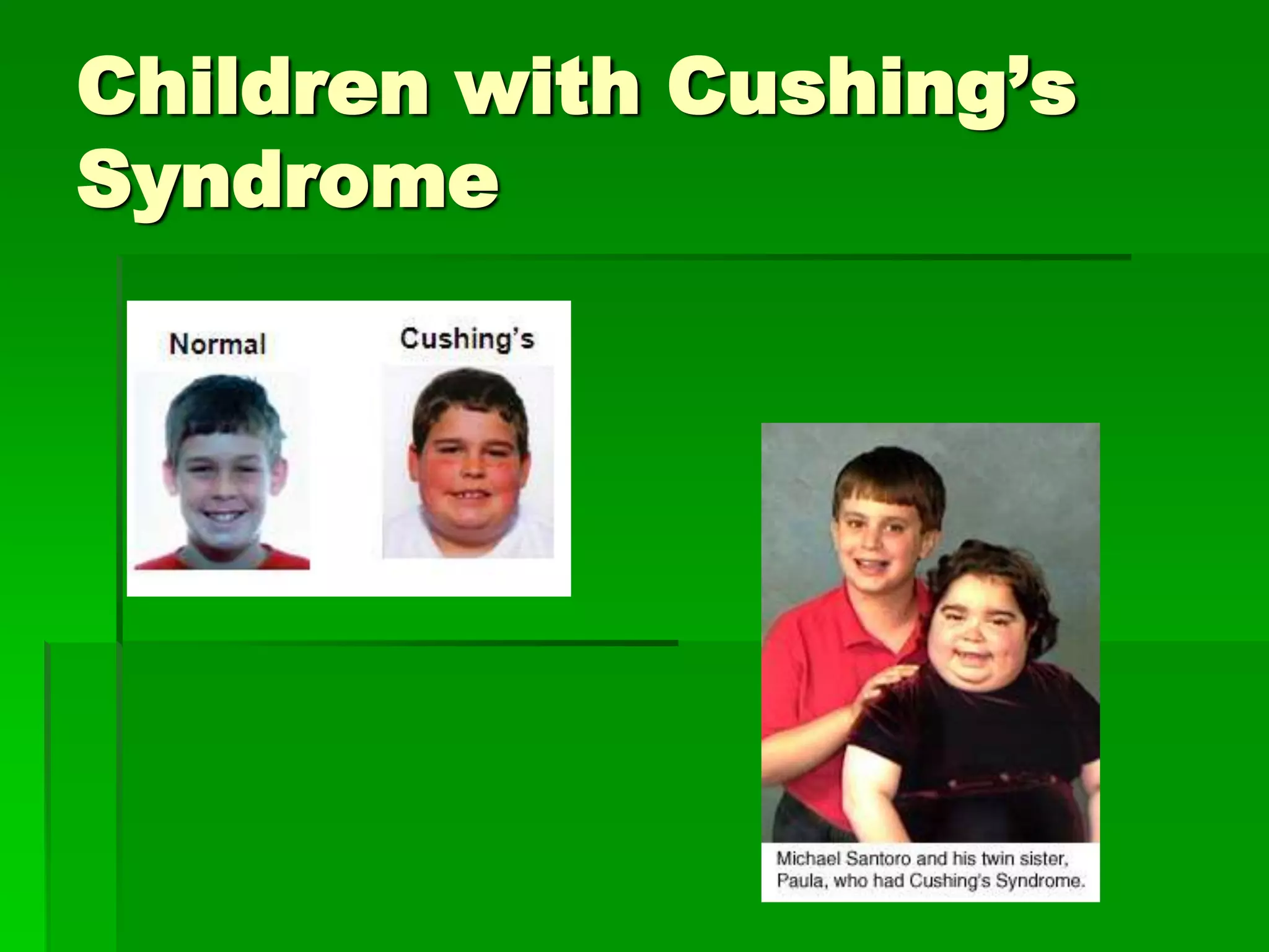 Cushings final project | PPTX