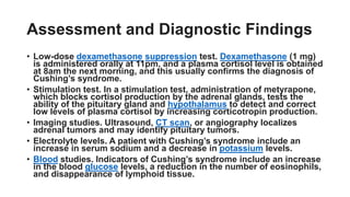 Cushing's syndrom.pptx
