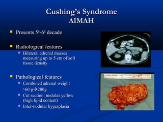 Cushing’s syndrome | PPT