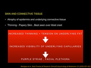 Cushing's syndrome | PPTX