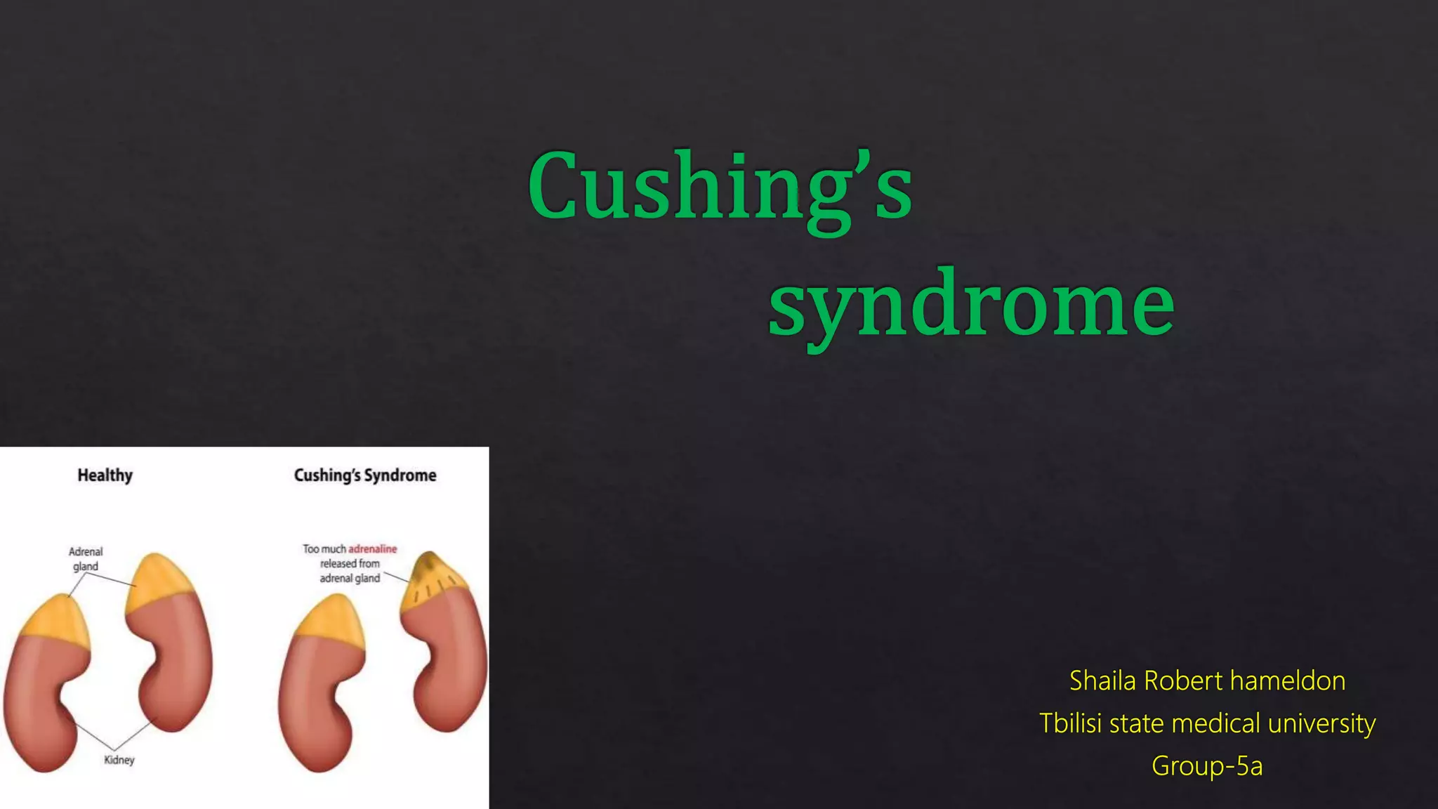 Cushing's syndrome presentation | PPT