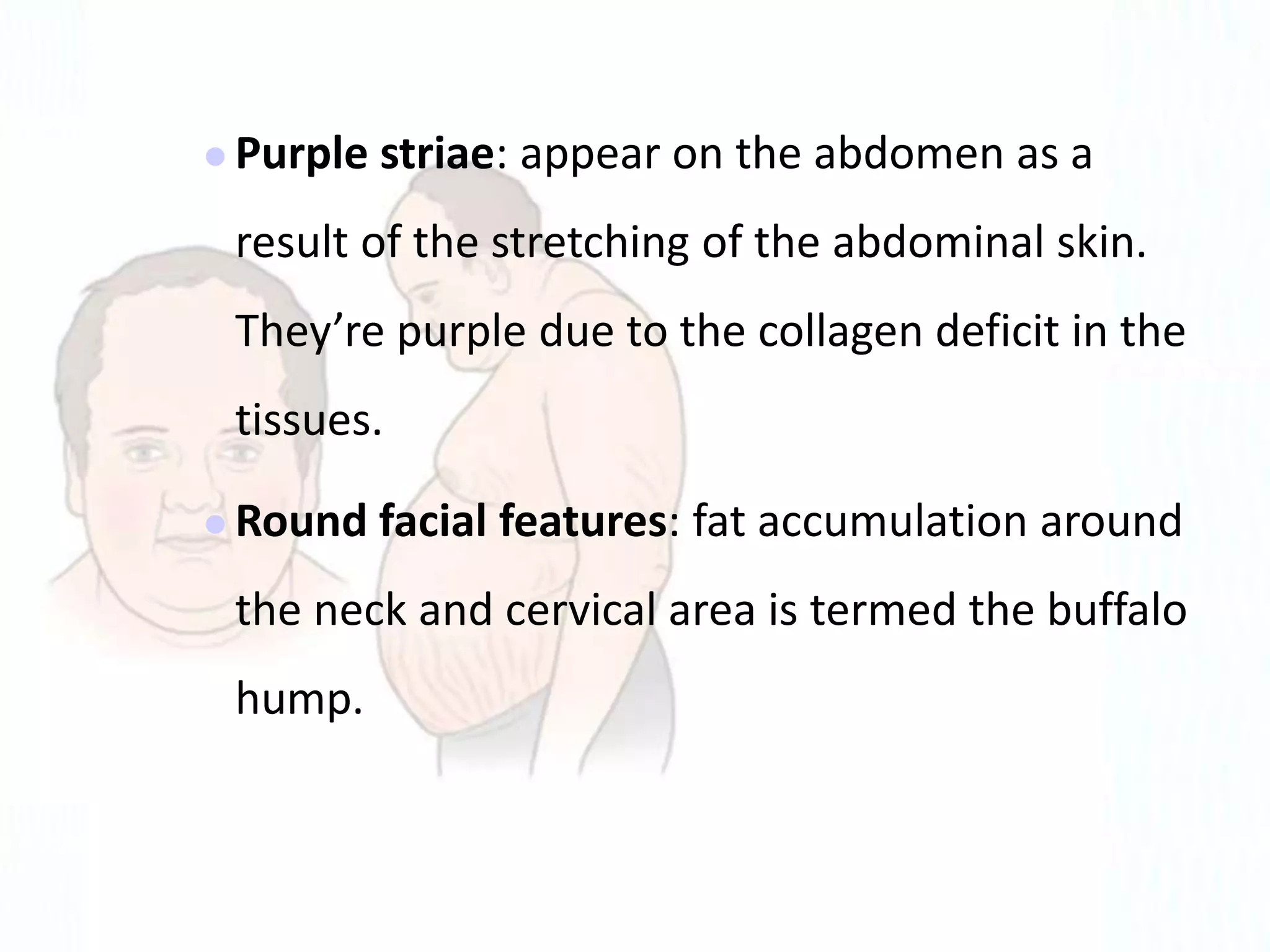 Cushing Syndrome | PPT