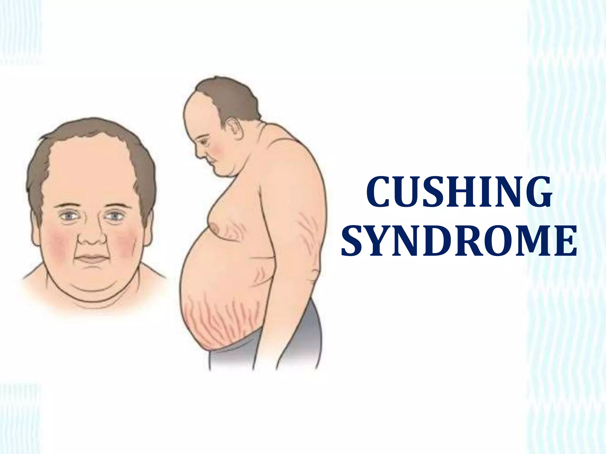 Cushing Syndrome and Pheochromocytoma: Signs, Symptoms, and Treatment | PPT