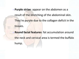Cushing Syndrome | PPT